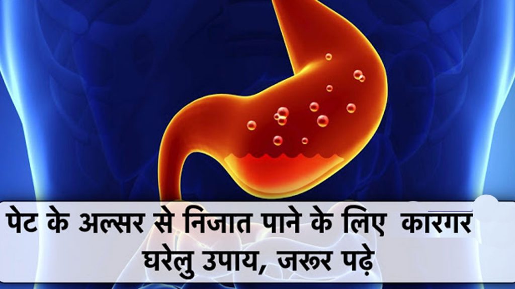 ALSAR copy – Only Ayurved